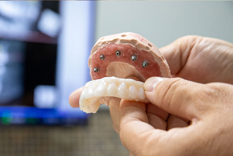 Snap-In Dentures | Port Orange, FL | White Wolf Dental Group